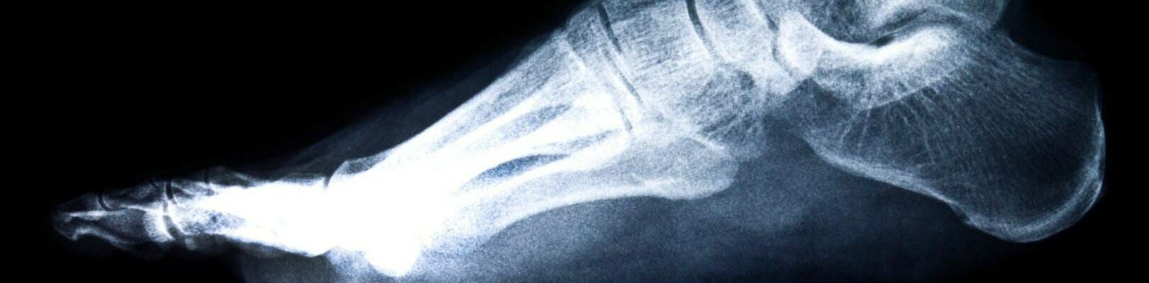 10 Fun feet Facts - A Step Ahead Podiatry